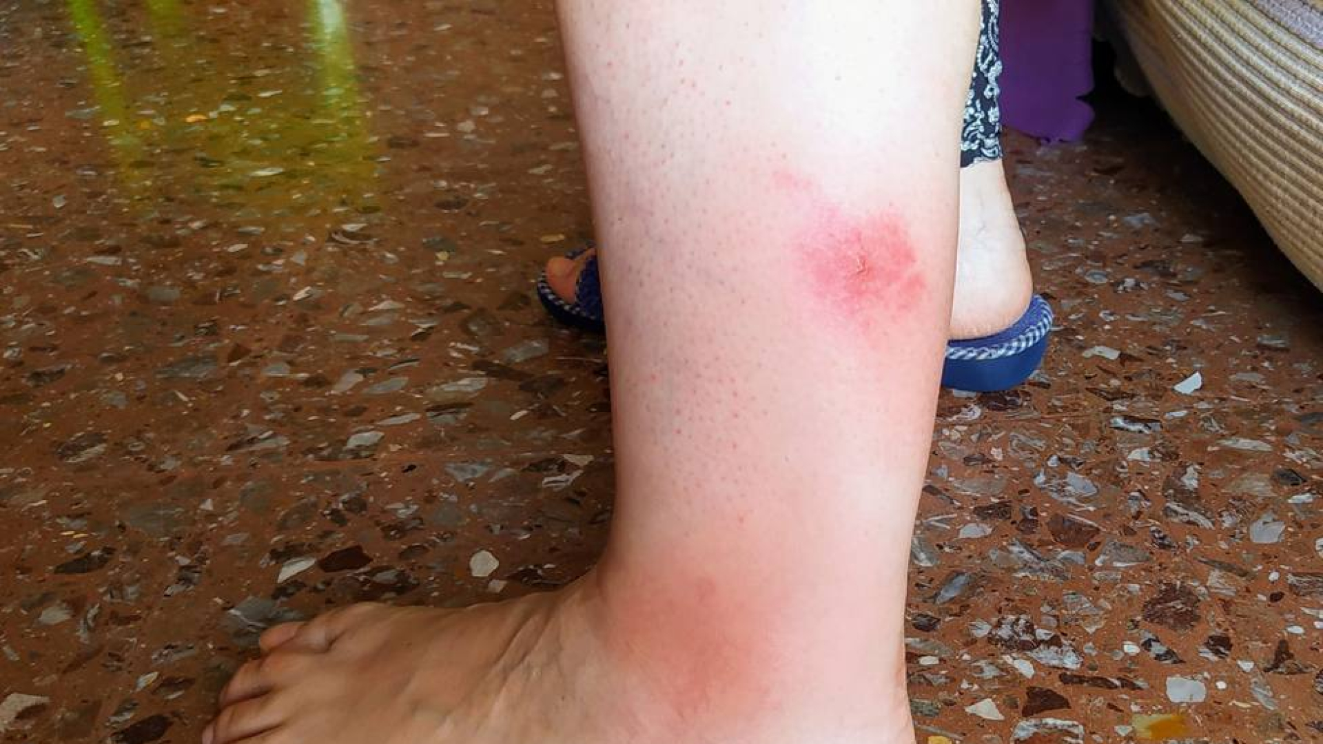 Entrevista al médico de Atención Primaria, José Manuel Cucalón, sobre ...